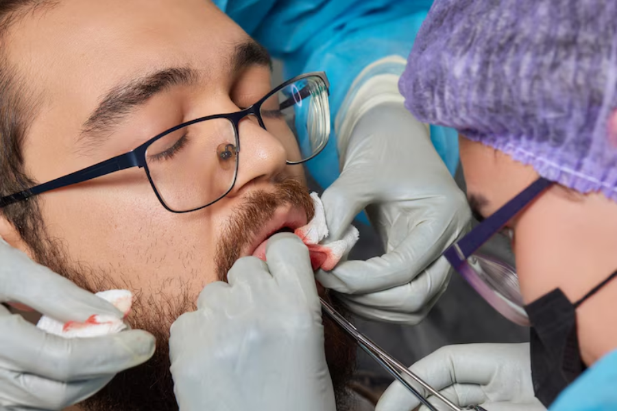 Stopping Tooth Extraction Bleeding Essential Tips And Remedies Stopping Tooth Extraction Bleeding Essential Tips And Remedies